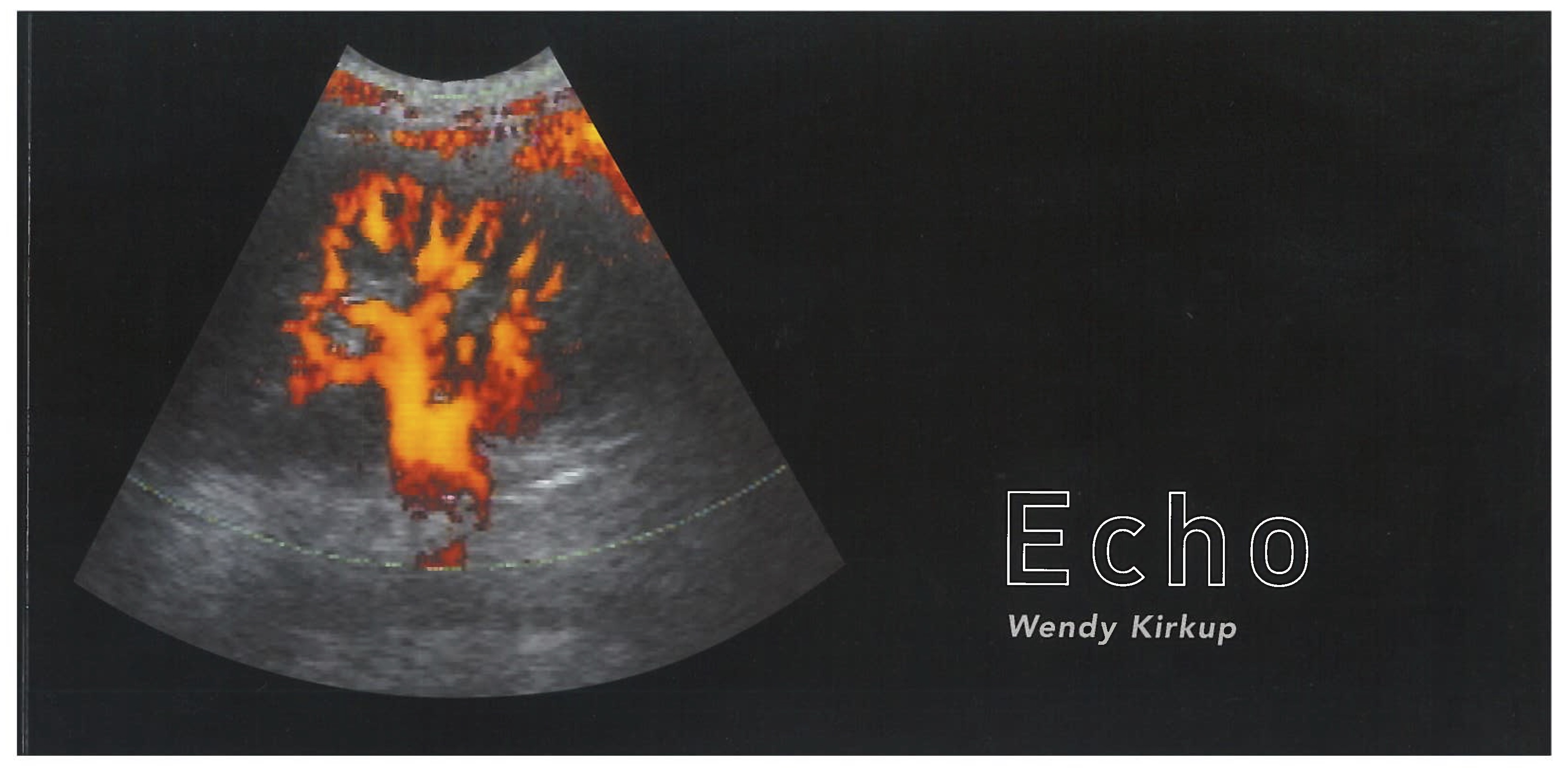 Echo – Wendy Kirkup